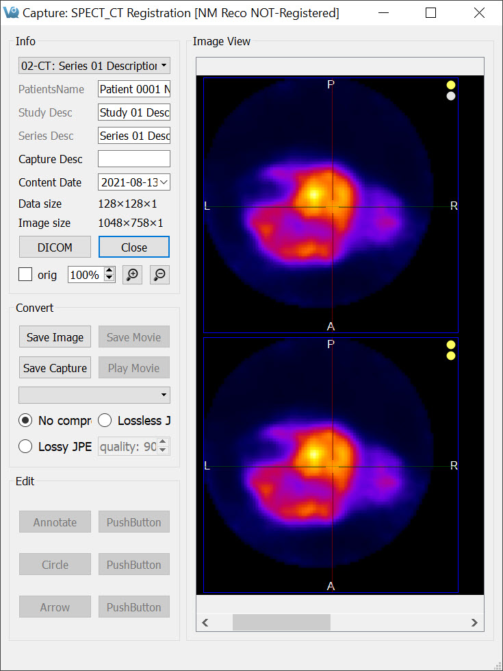 Capture Viewer | VivoQuant User Manual